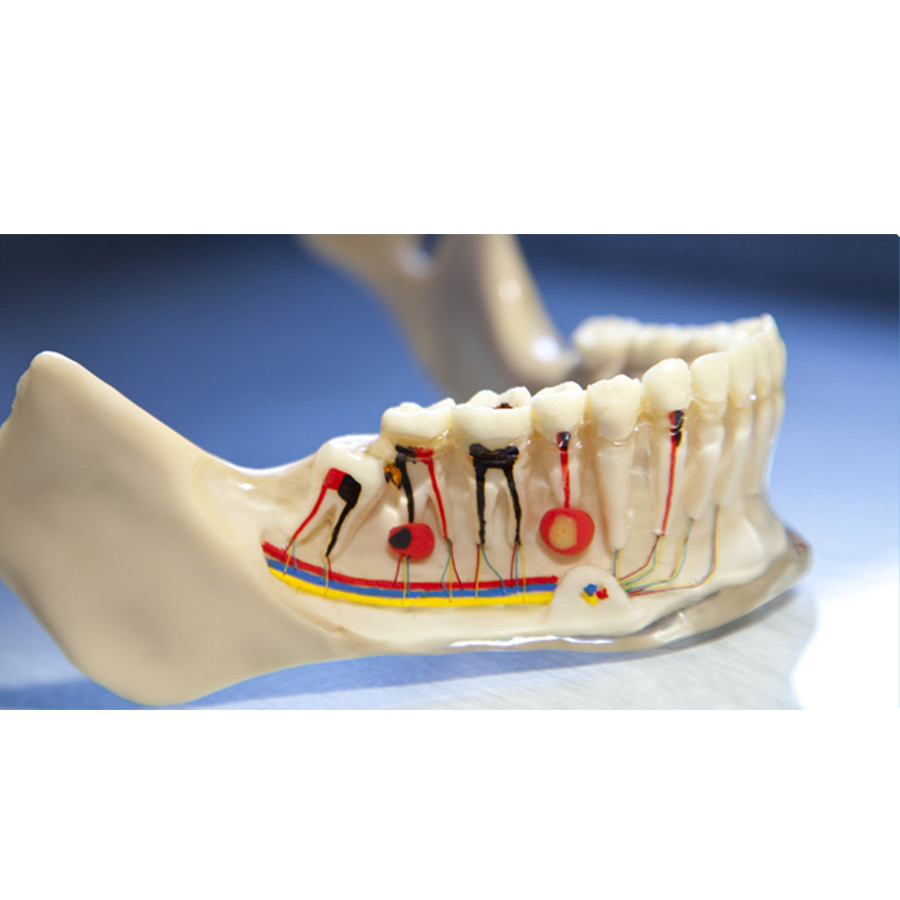 Endodoncija – liječenje zubnih kanala